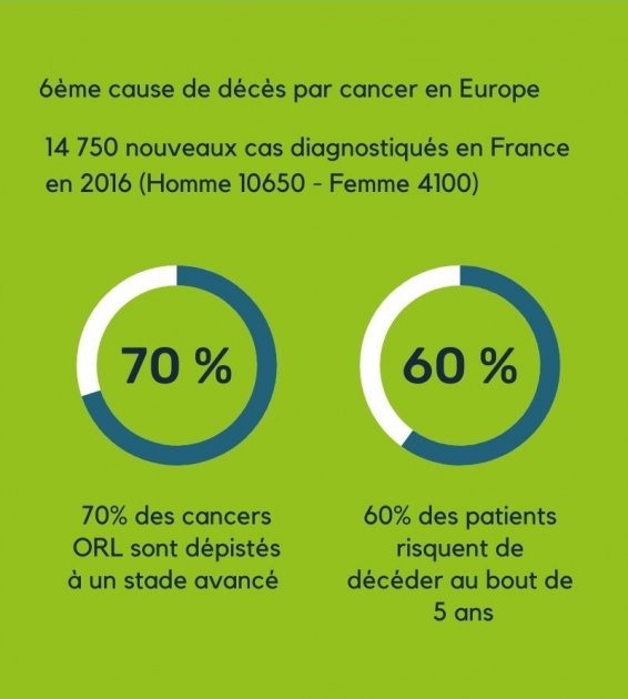 Les cancers orl - dépistage - Tous les articles - cancer solidarité vie