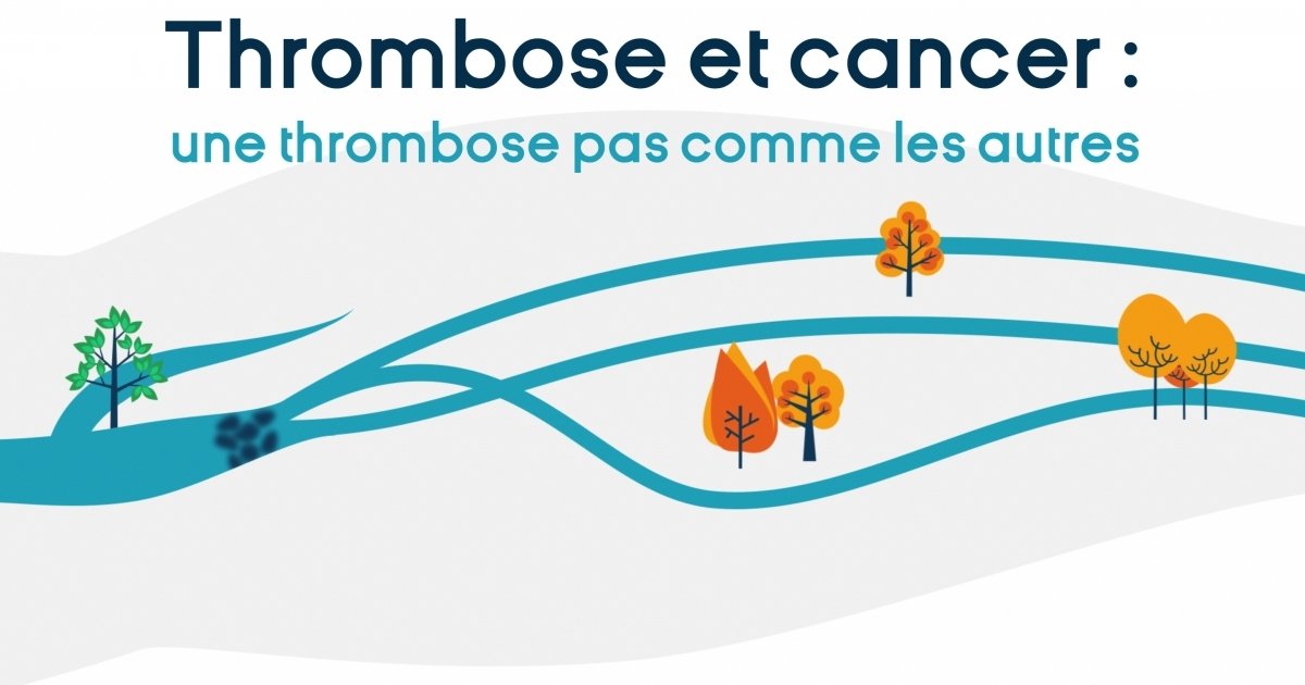 Thrombose et cancer : une thrombose pas comme les autres… - Questions